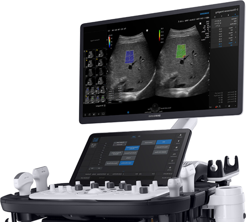 Ultrasound scan - Help-MR Diagnosztika